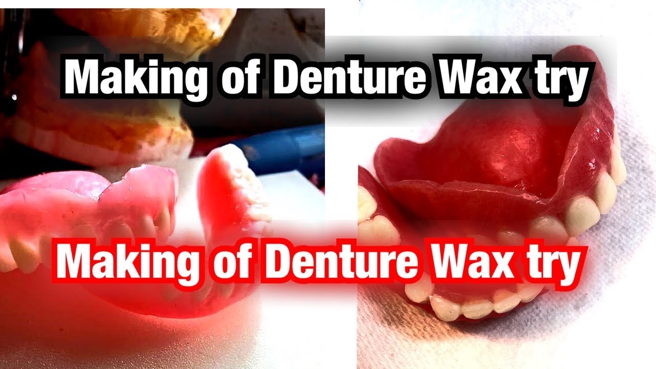 Making Dentures Wax Trying Youtube