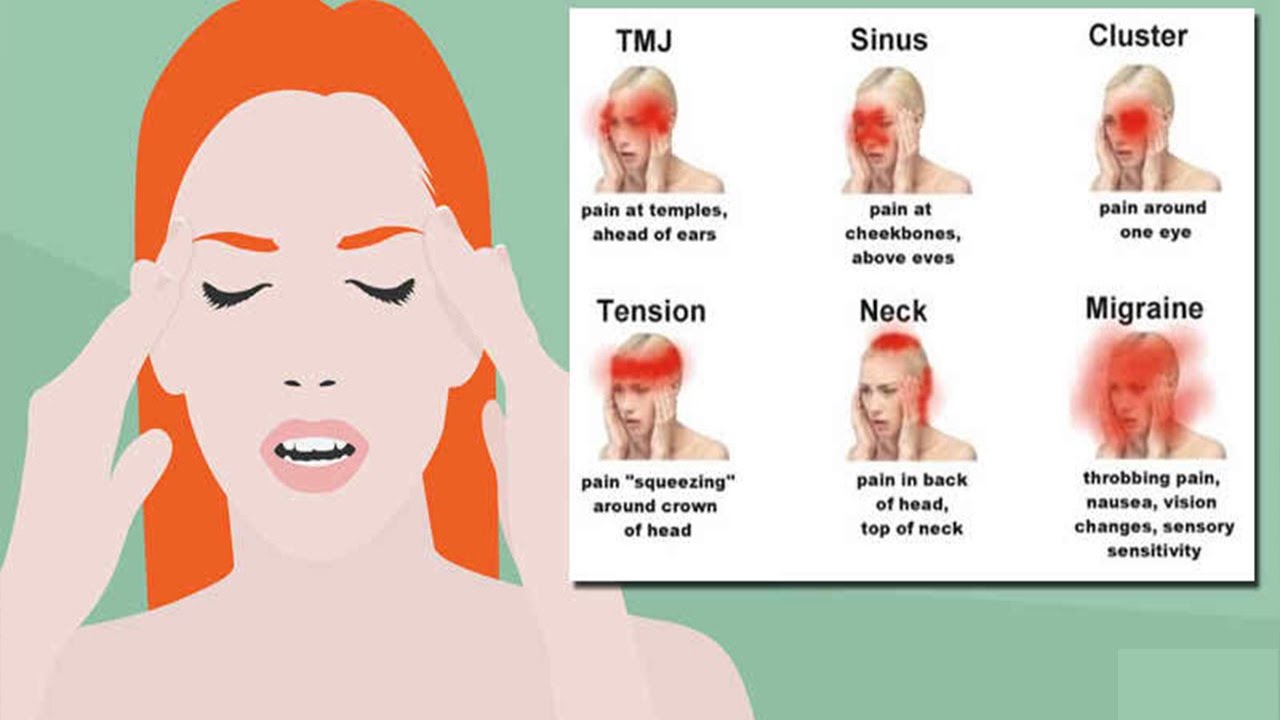 Chart Showing Types Of Headaches