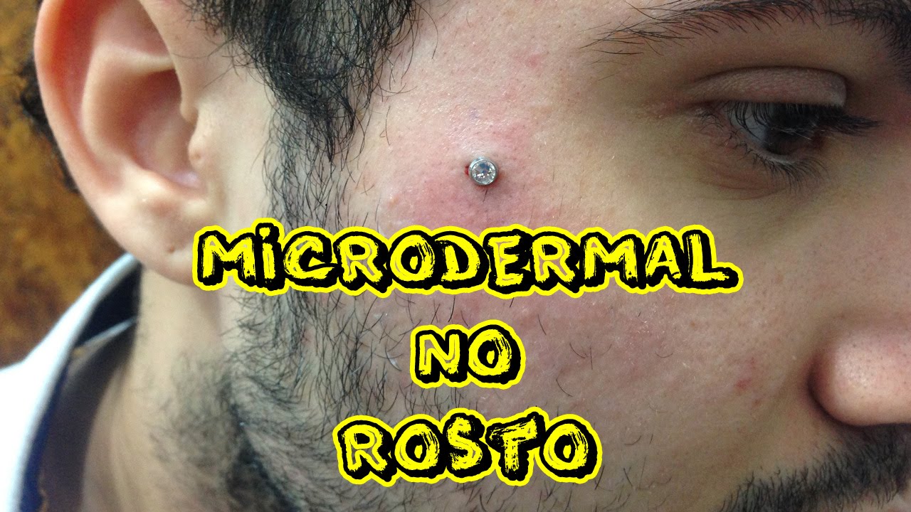 Microdermal Rosto Youtube