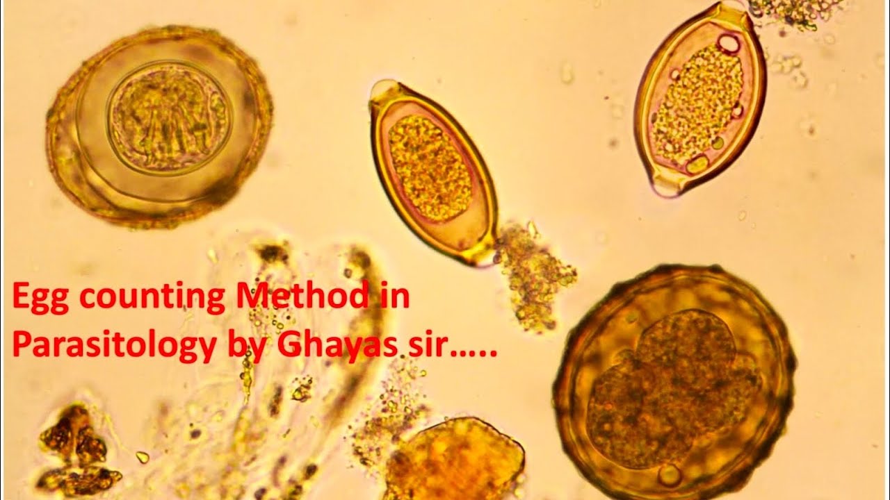 Egg Counting Method In Parasitology By Ghayas Sir Youtube