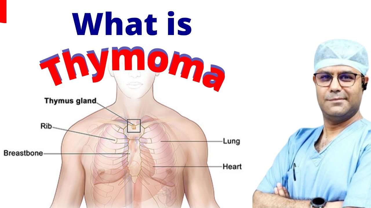 Thymoma And Thymic Carcinoma Treatment Nci 52 Off