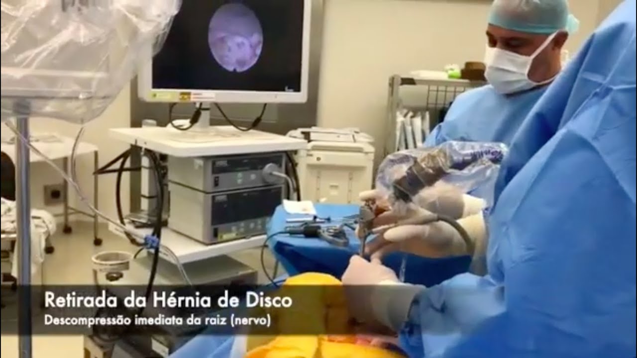 Cirurgia De Hérnia De Disco Por Vídeo Youtube