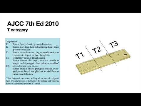 Opscc Ajcc 8th Tnm With Examples Youtube