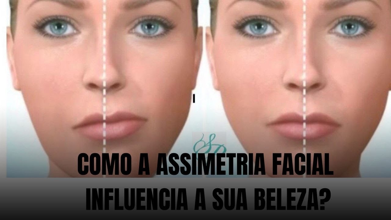 Como A Assimetria Facial Influencia A Sua Beleza Youtube