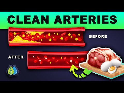 Top 10 Foods That Unclog Arteries Naturally And Prevent Heart Attack