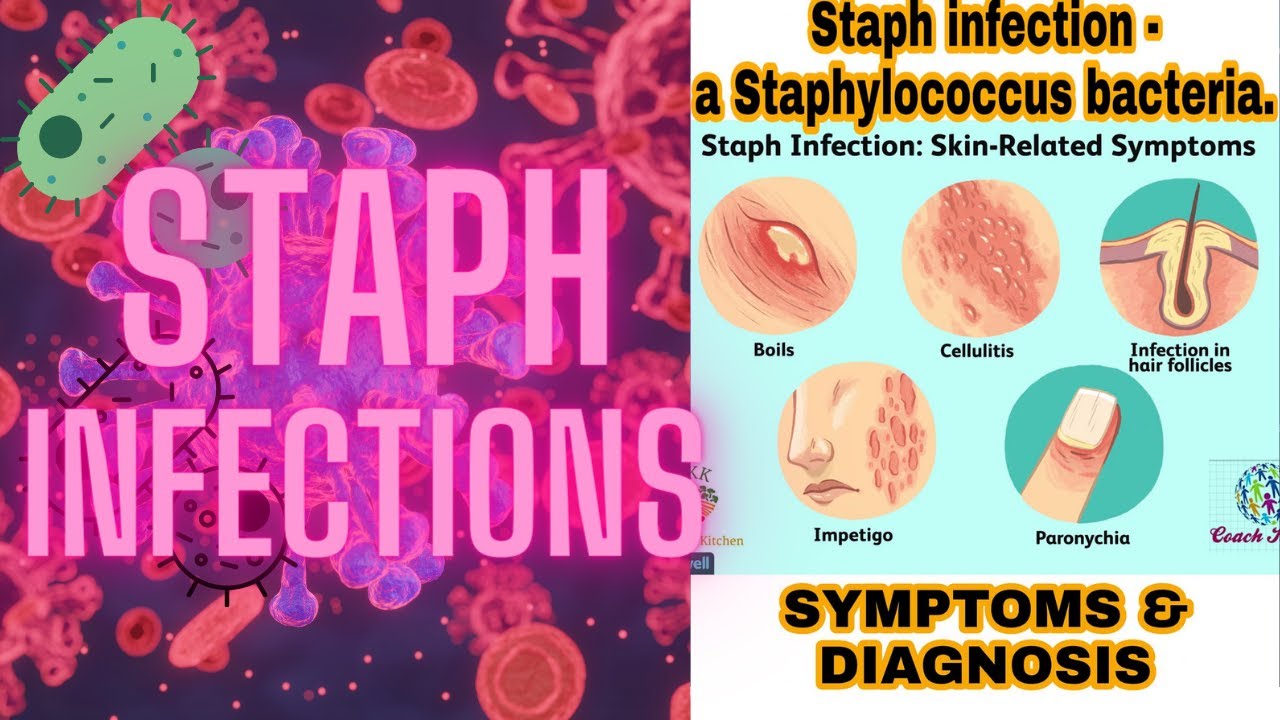 Staph Infections Staphylococcus Infection Easy Microbiology Youtube
