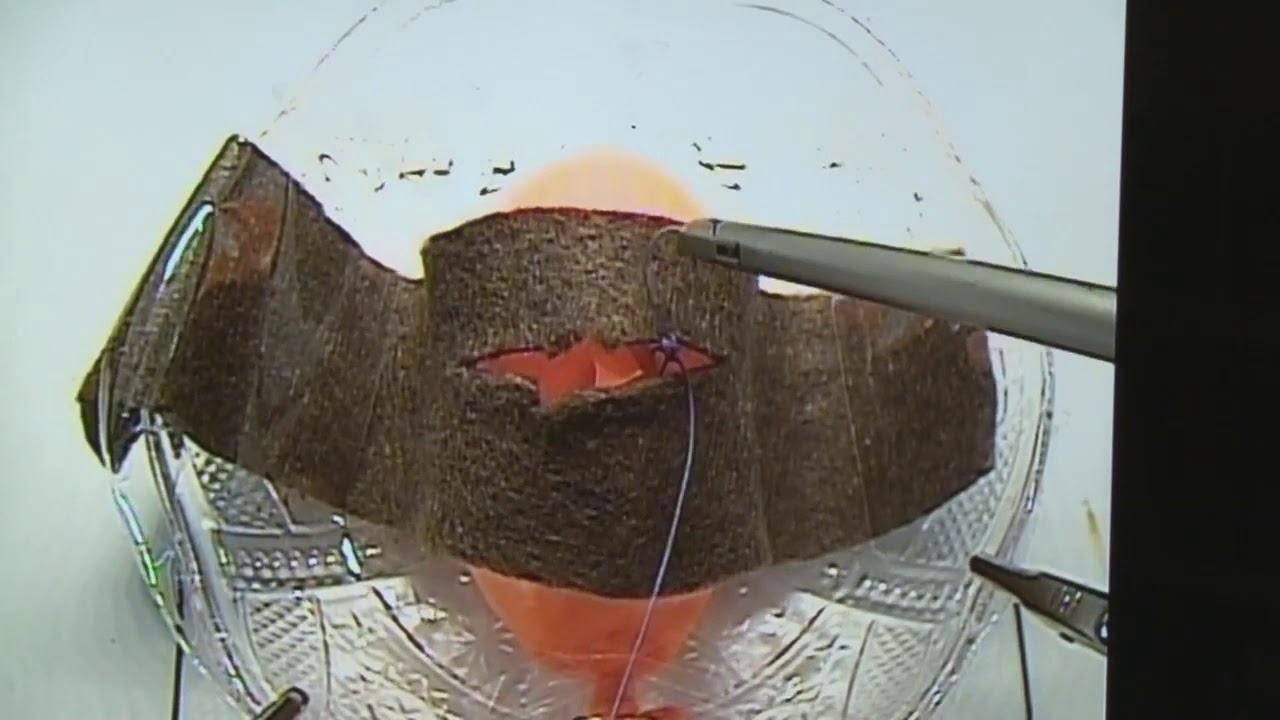19 121 Gyn Cystotomy Repair Simulation Transferring A Laparotomy