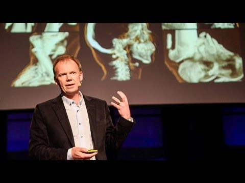 Visualizing The Medical Data Explosion Anders Ynnerman Video