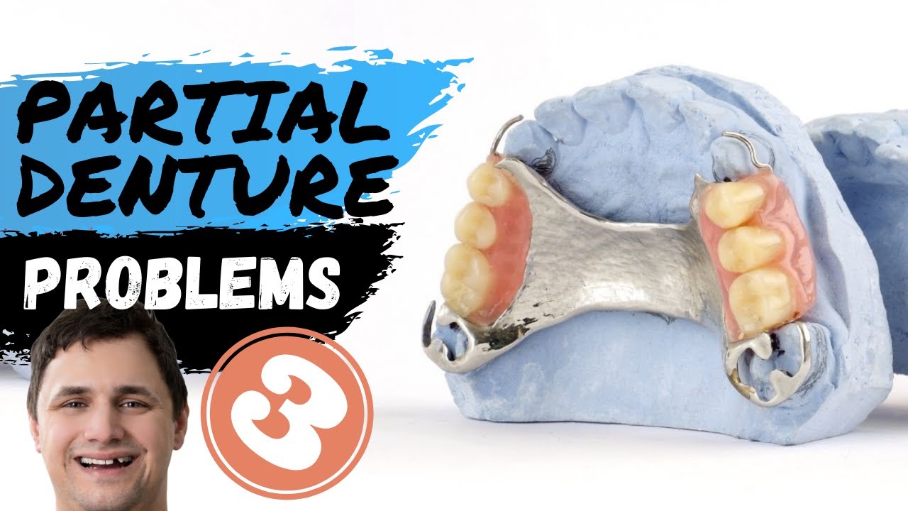 Problems With Partial Dentures Removable Denture Types Youtube