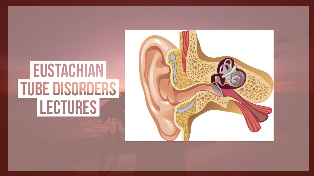 Small Eustachian Tubes In Adults At Tara Brothers Blog