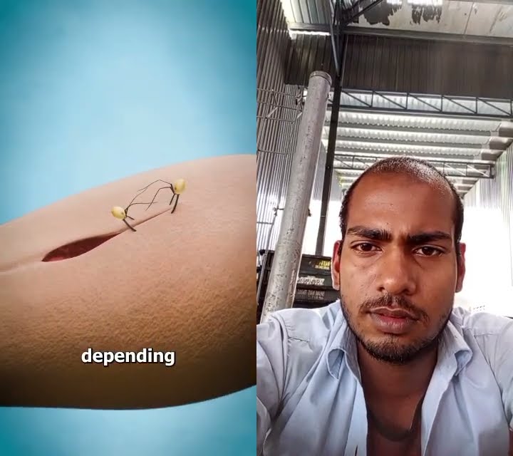 Using Ants To Stitch Wounds рџђњ Shorts Youtube