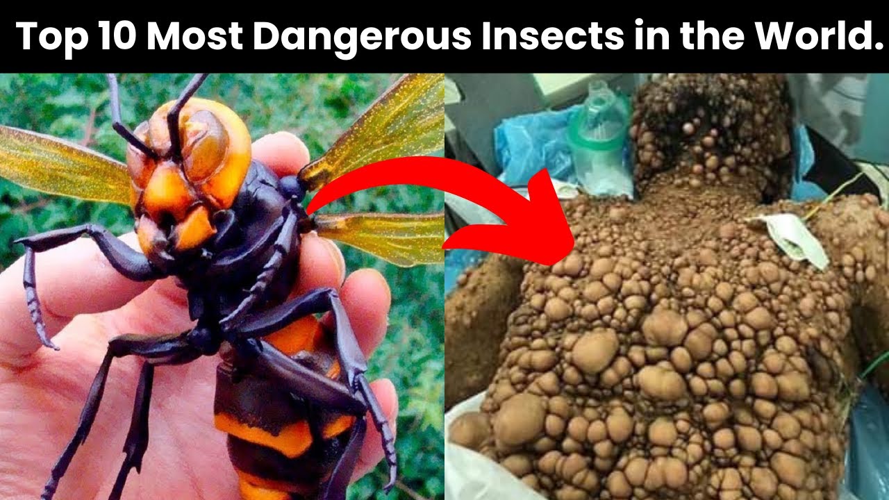 10 Most Deadliest Insects In The World Dangerousinsects Youtube