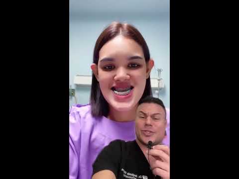 Insane Jaw Transformation Shorts Youtube