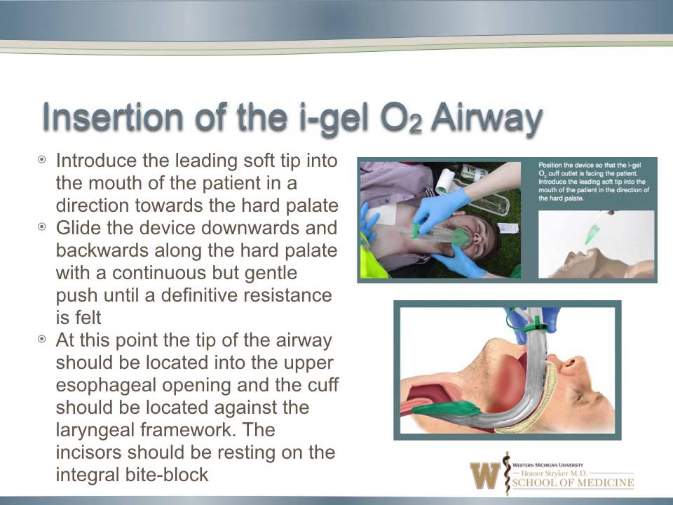 I Gel Airway Inservice Part 2 Youtube
