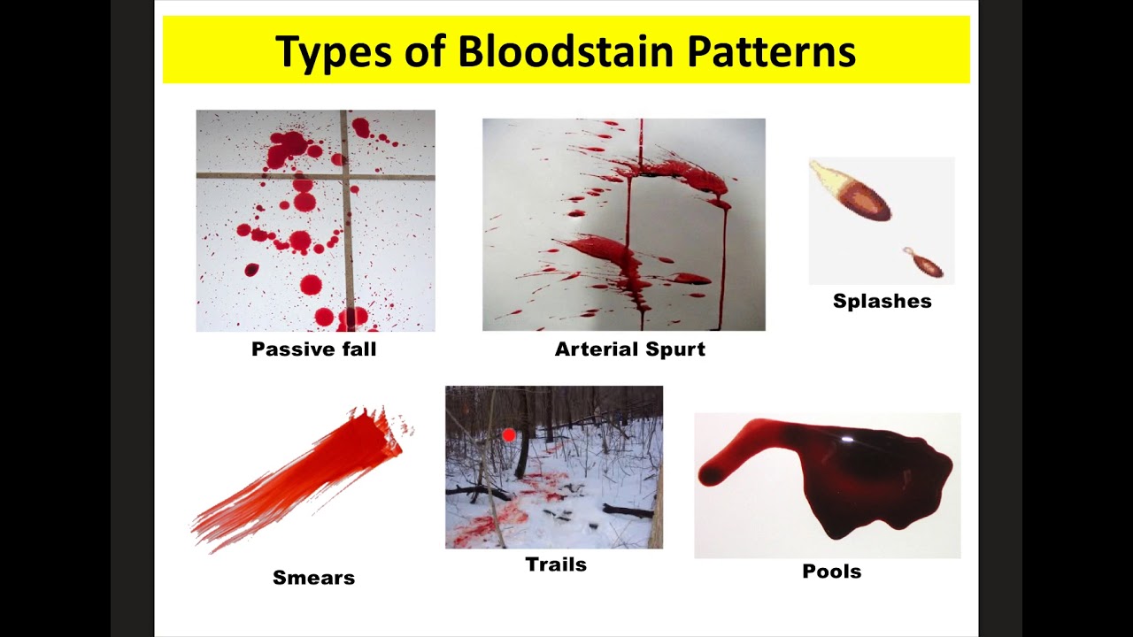 Three Types Of Bloodstain Patterns At Winston Blanton Blog