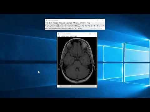 Imagej Fiji Tutorial Creating Montage From Stack Tiff Youtube