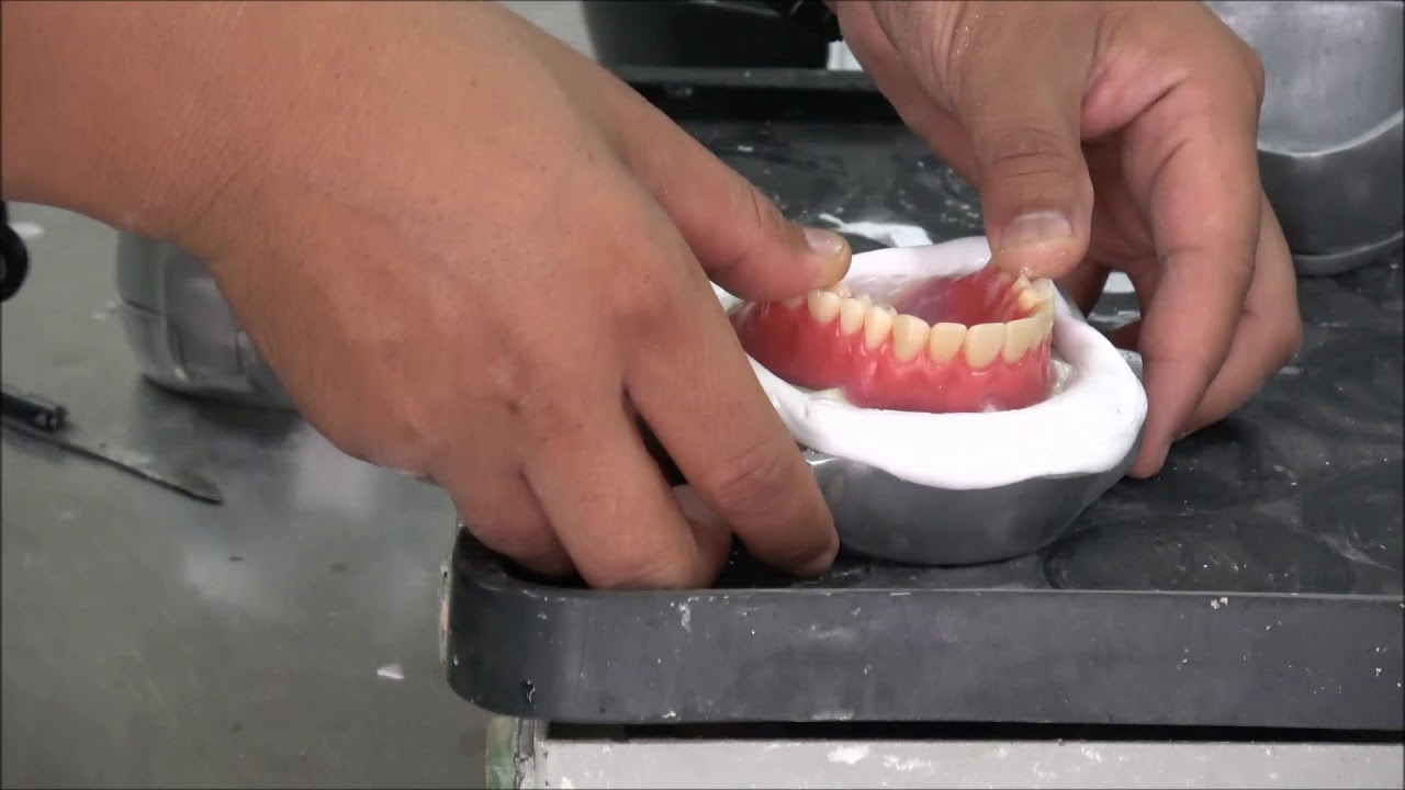 Complete Denture 14 Flasking And Investing Youtube