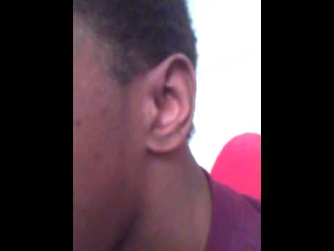 My Ear Started Wiggling Up And Down Youtube