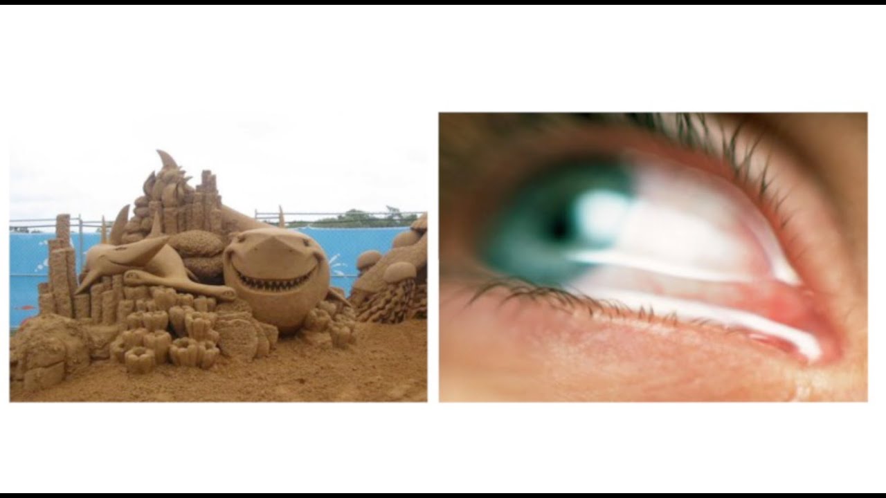 What To Do If You Cry When You Yawn At Sandra Anker Blog