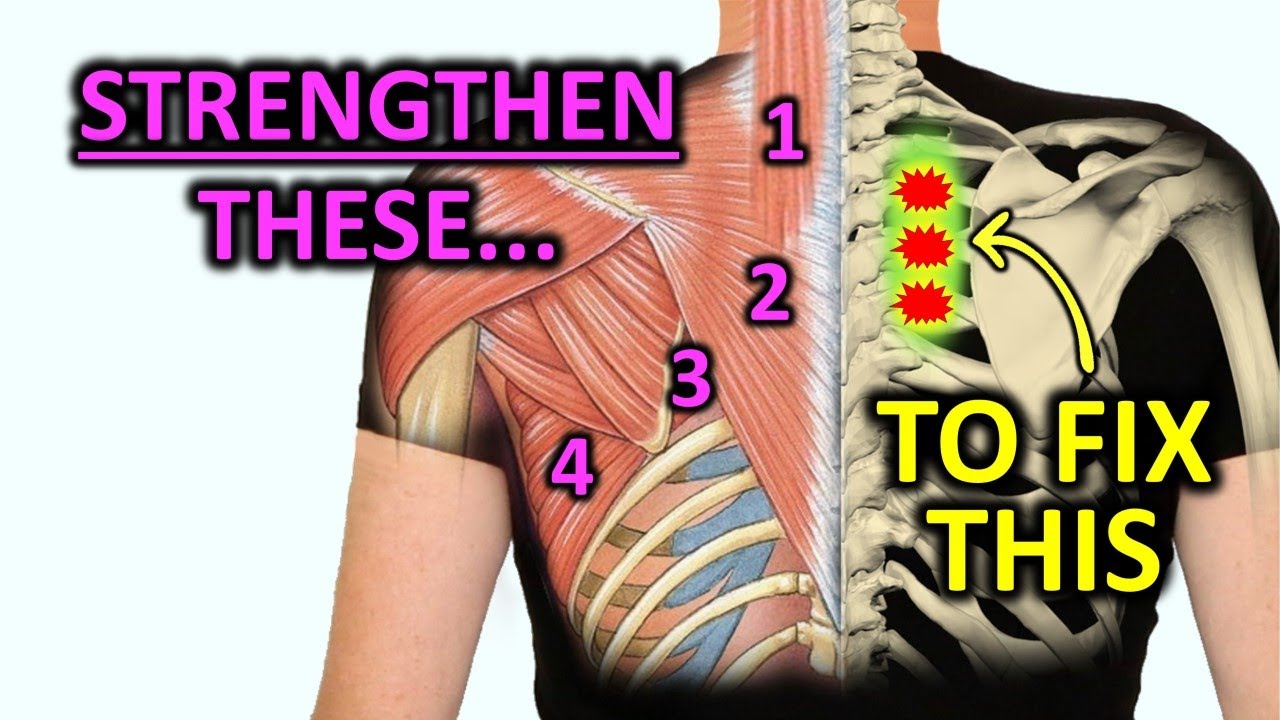 Strengthen These Muscles To Fix Rhomboid Pain Youtube