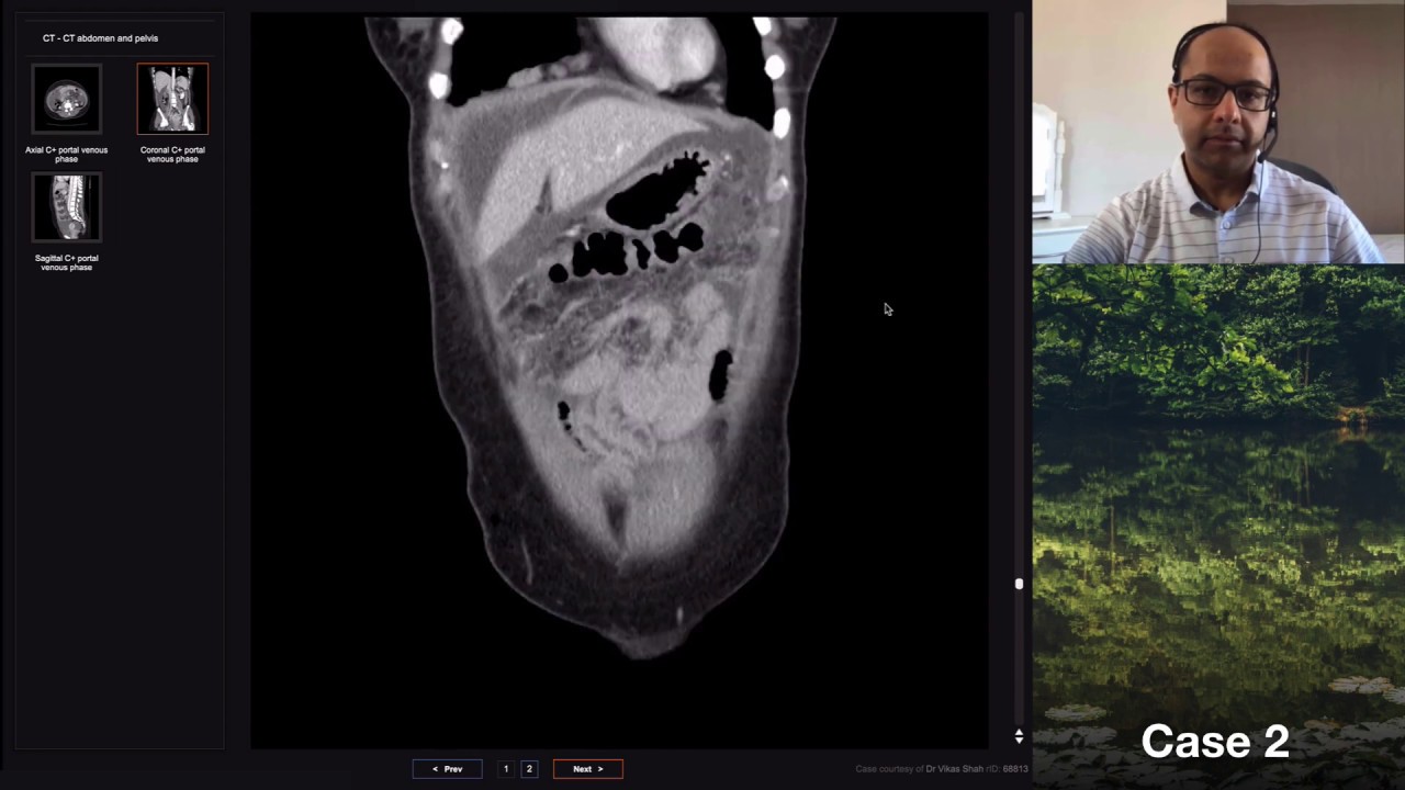Isolation Tutorial Abdominal Ct 3 With Vikas Shah Youtube