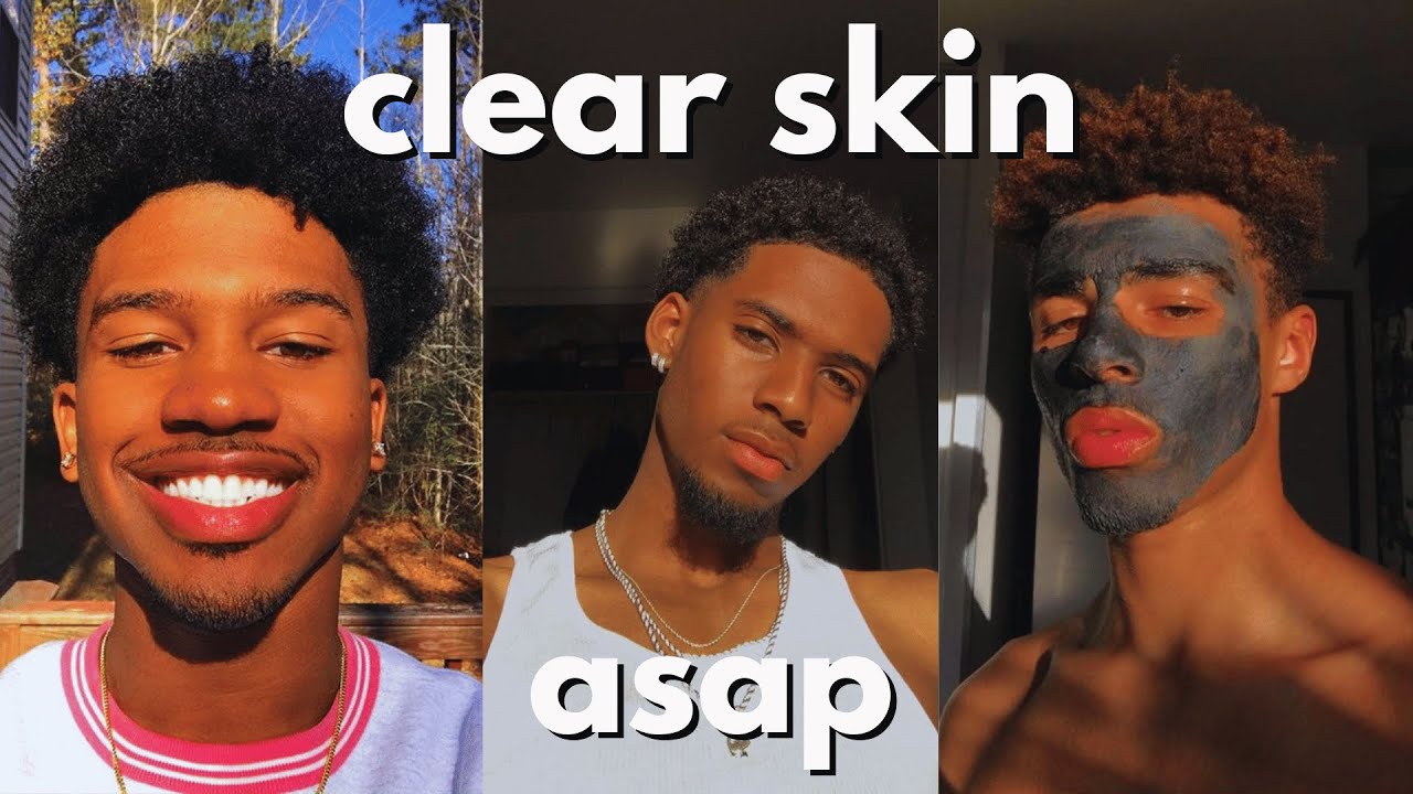 How To Get Clear Skin For Guys Asap No Bs Guide Youtube