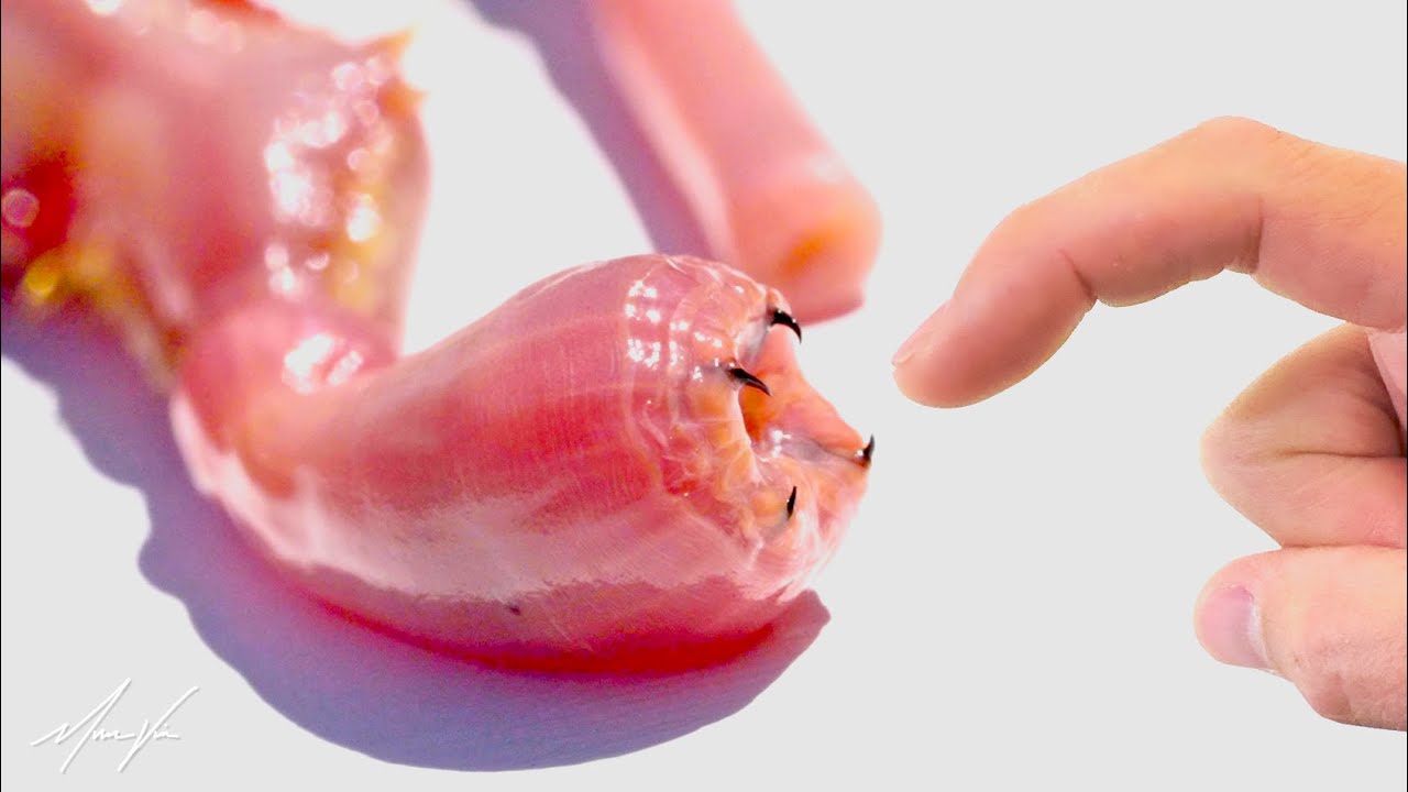 Bloodworm Bite Worst Ever Youtube