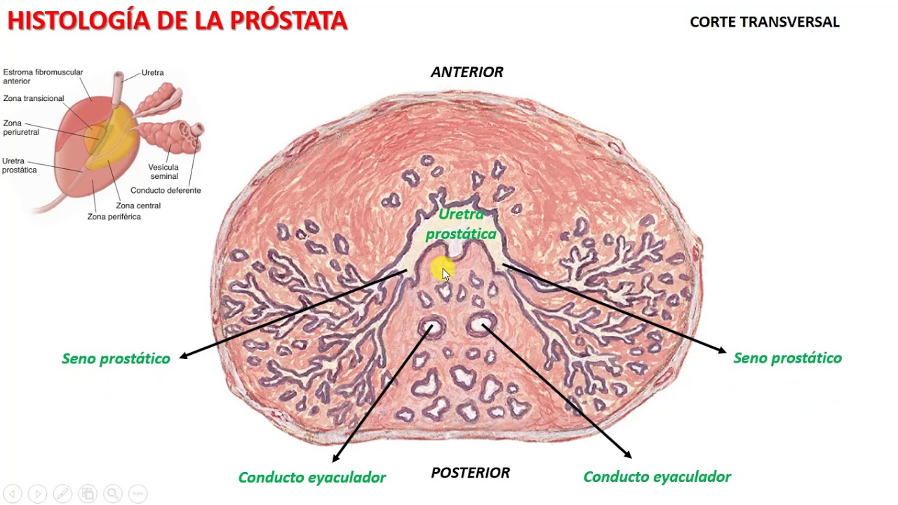 Histología De La Próstata Ver Descrip Ción Youtube