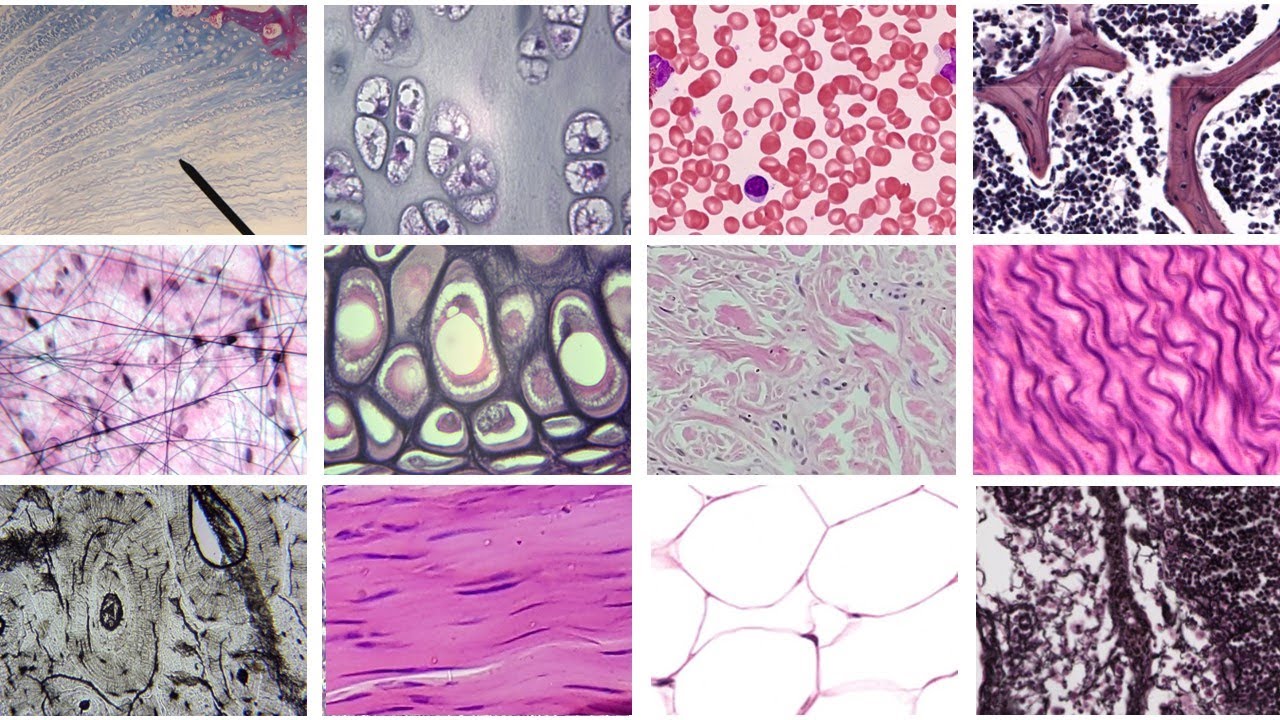 Practice Identifying Connective Tissue Complete Youtube