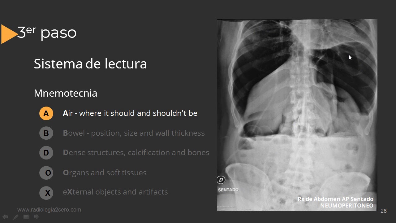 Guía Para Interpretar Una Radiografía De Abdomen Youtube