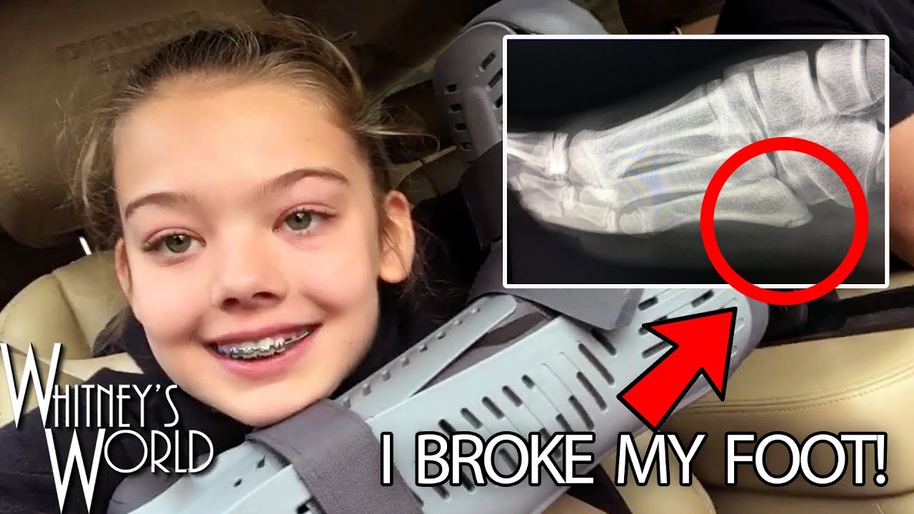 I Broke My Foot Whitney Bjerken Gymnastics Youtube