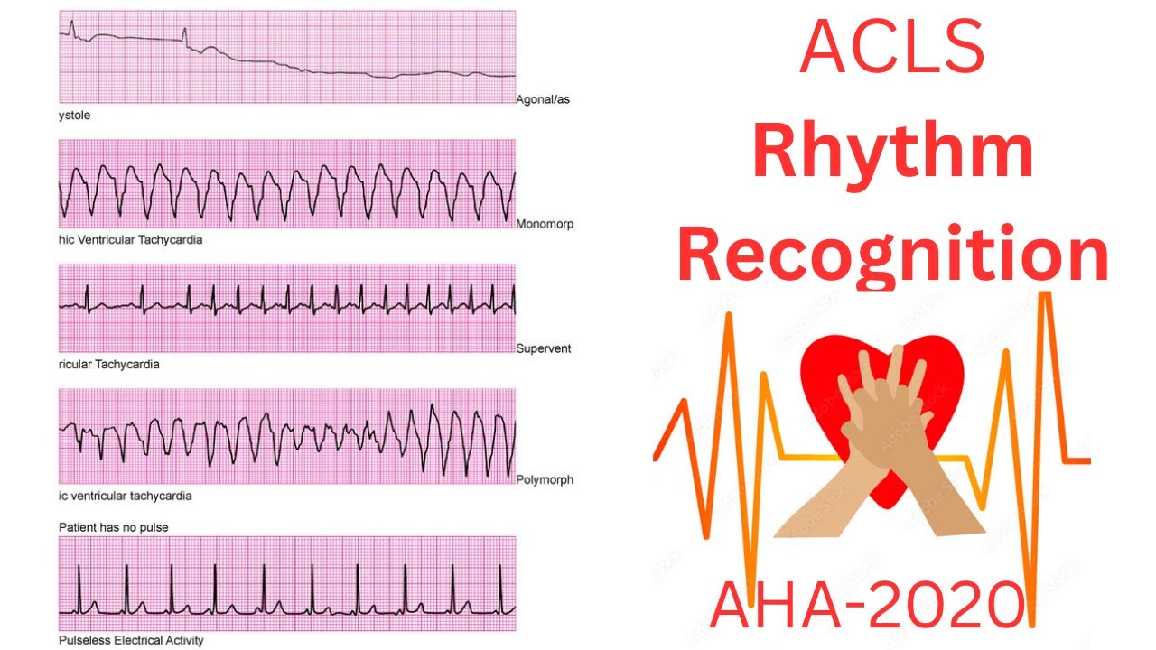 Acls Rythem Recognitions 2023 Easy Guide Youtube