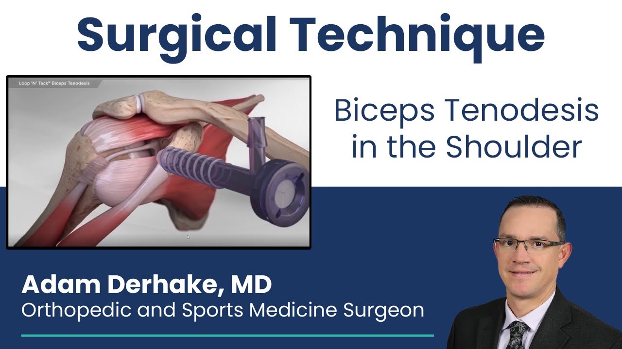 Biceps Tenodesis In The Shoulder Surgical Technique Youtube