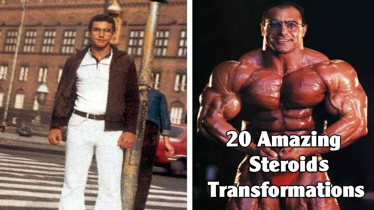 Bodybuilders On Steroids Before And After