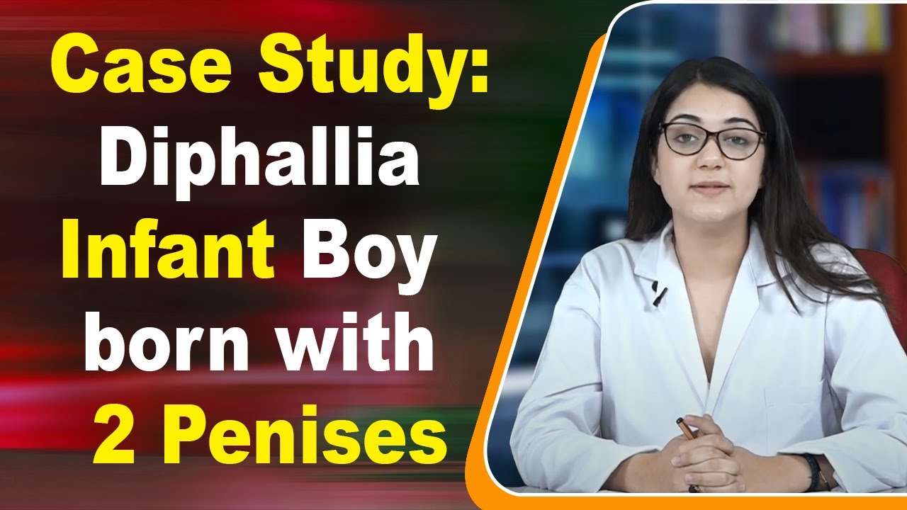 Case Study Diphallia Infant Boy Born With 2 Penises Youtube
