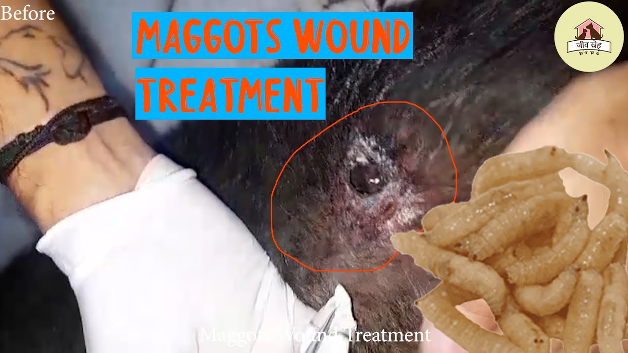Maggots Wound Treatment Youtube