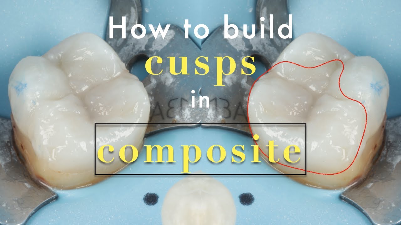 How To Build A Cusp In Composite Youtube