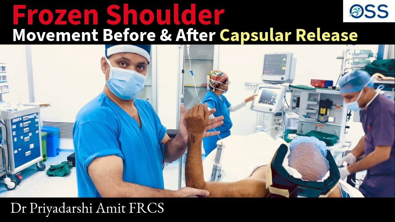 Frozen Shoulder Movement Before After Surgery Capsular Release