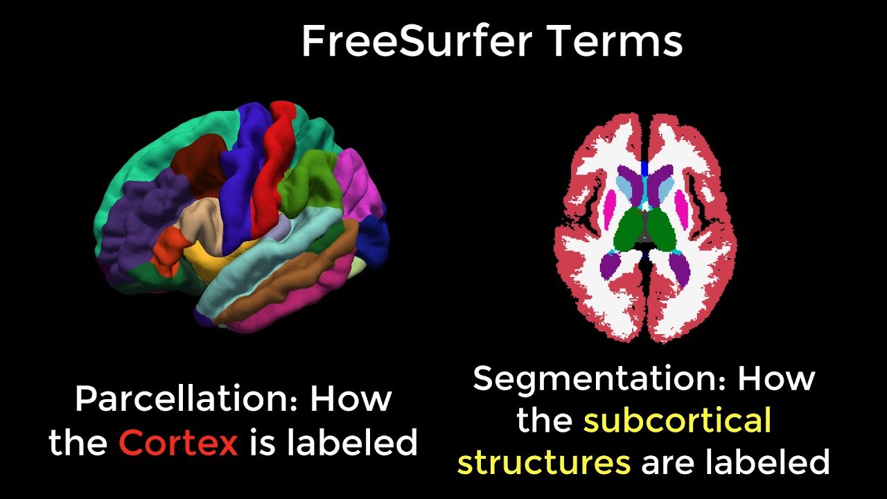 Freesurfer 1 Introduction Youtube