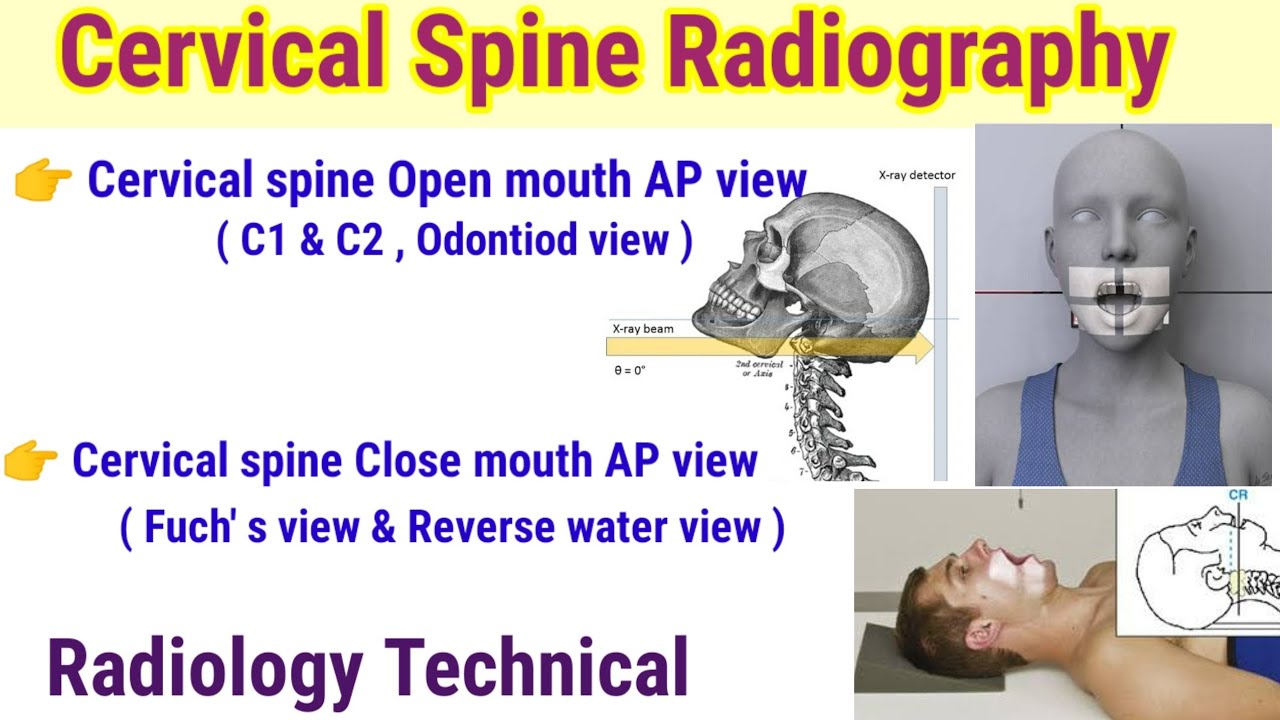 Cervical Spine Open Mouth Ap View Close Month Ap View X Ray