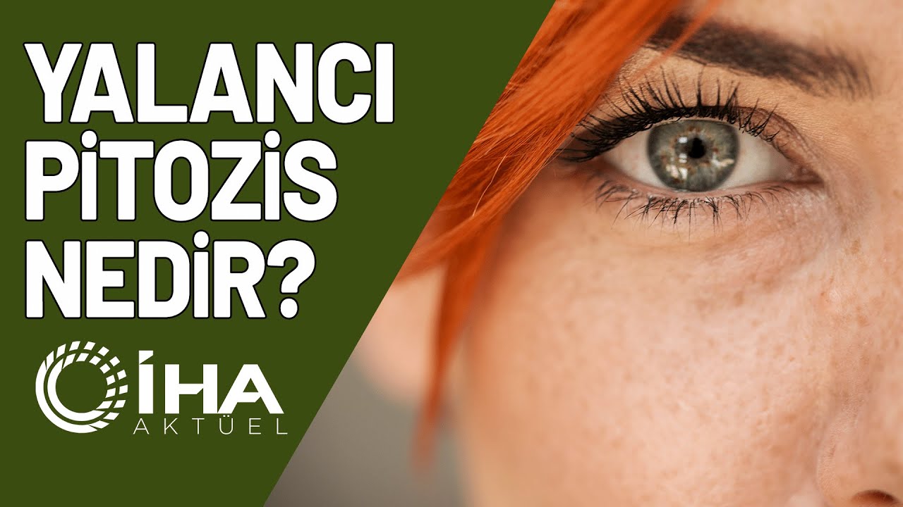 Yalancı Pitozis Nedir Youtube