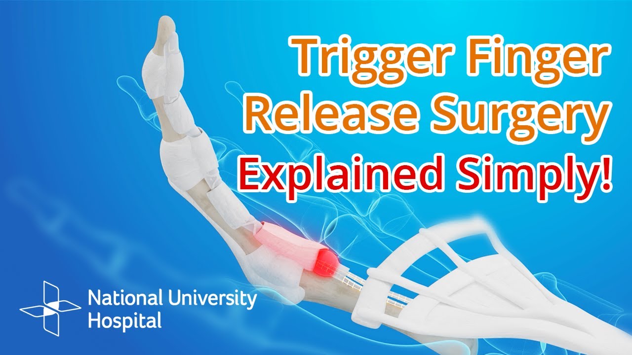 Trigger Finger Surgery See Real Before After Recovery Photos