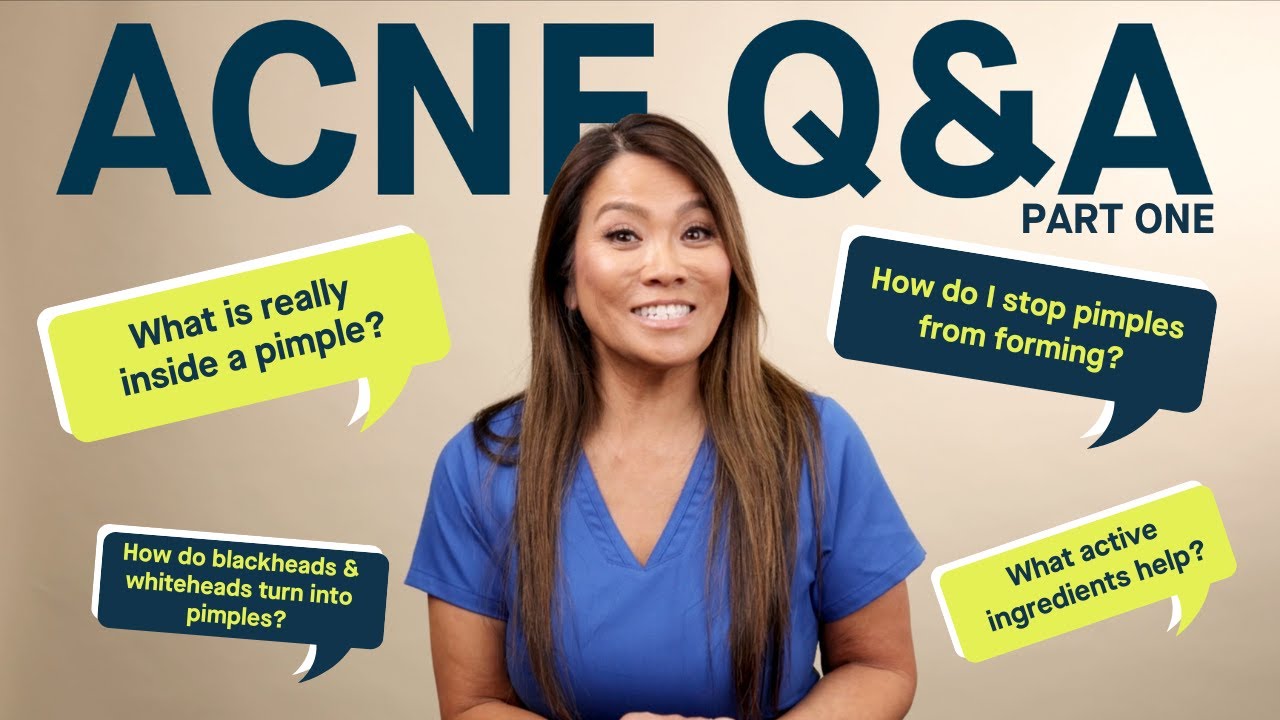 How To Stop Deep Pimples From Forming At Esther Corbett Blog