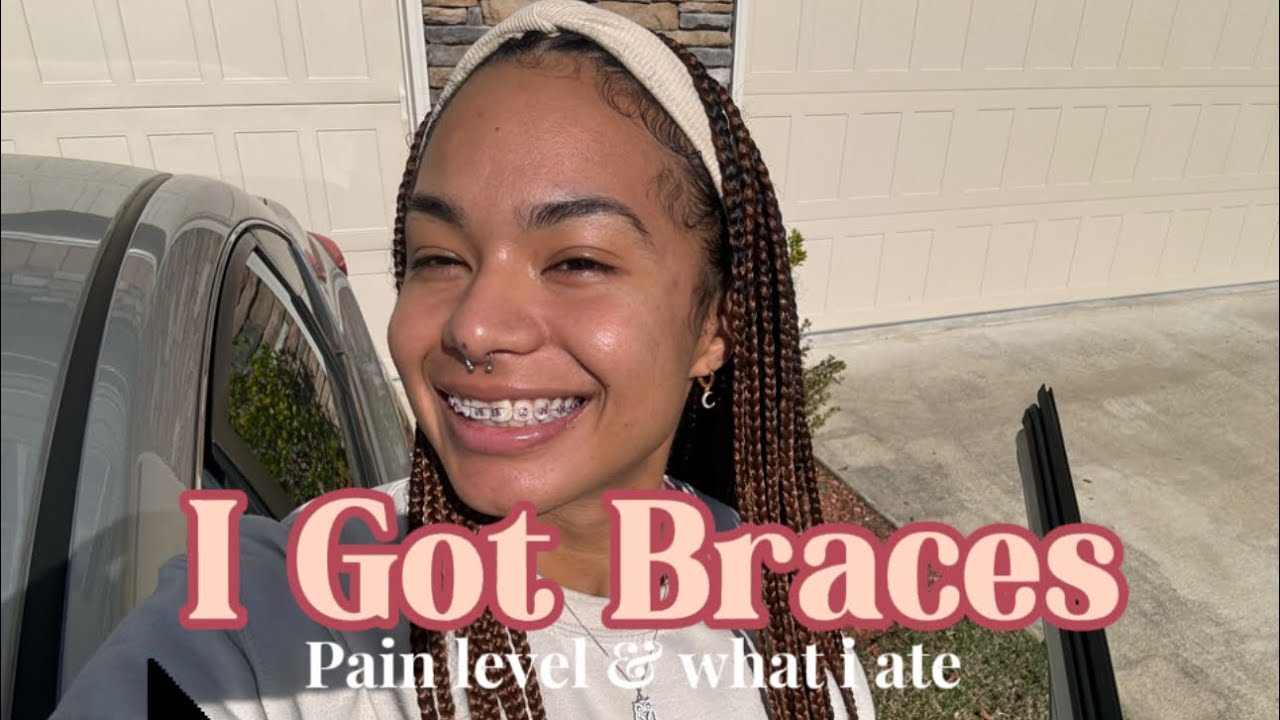Braces Vlog Youtube