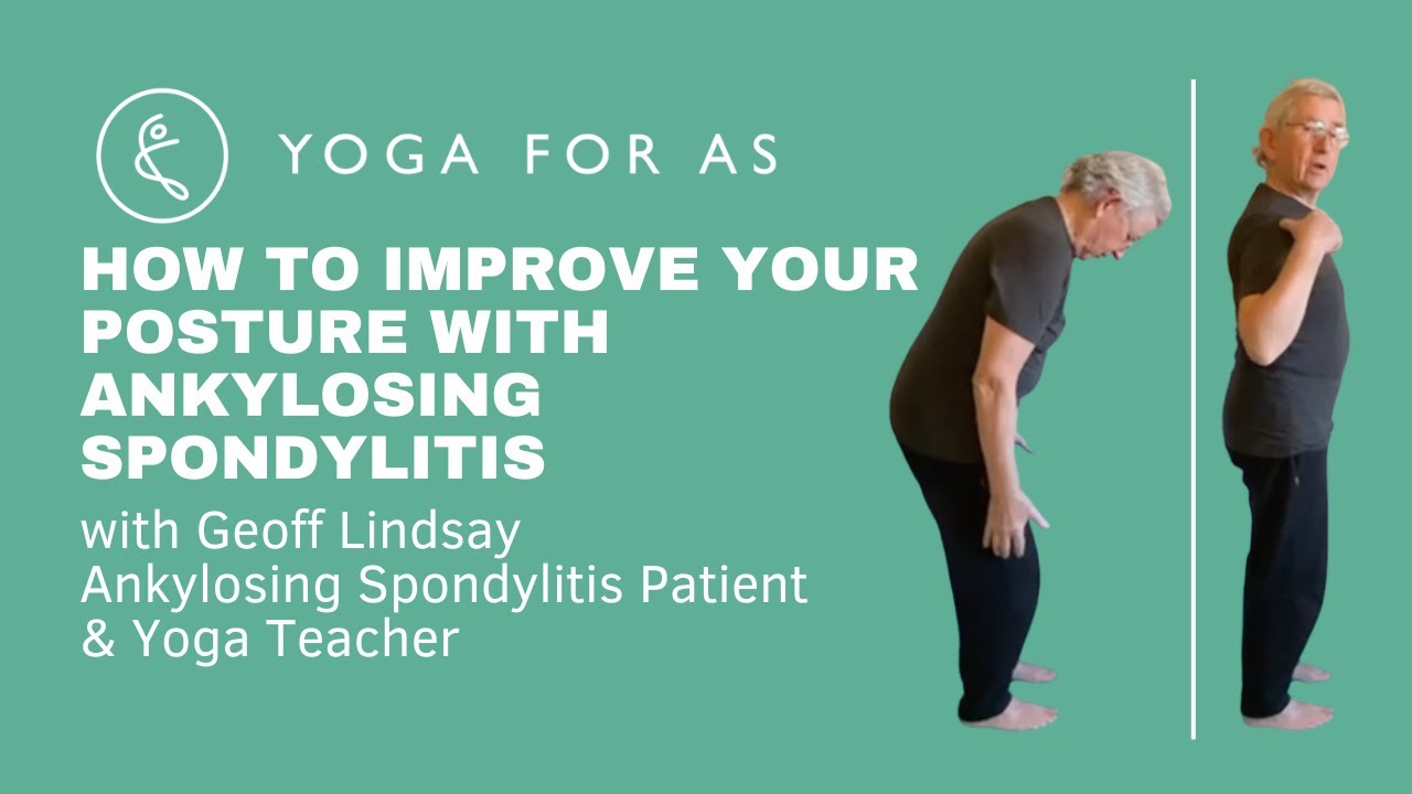 Ankylosing Spondylitis Patient