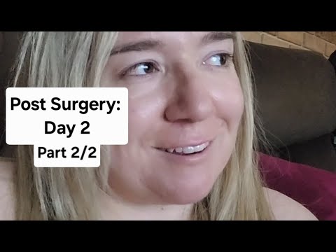 Part 2 2 Post Surgery Day 2 Youtube