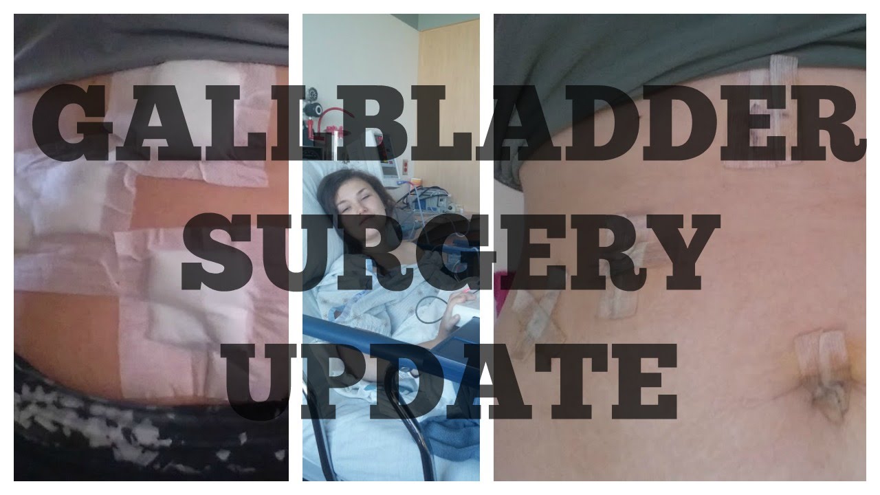 Surgery Update Youtube