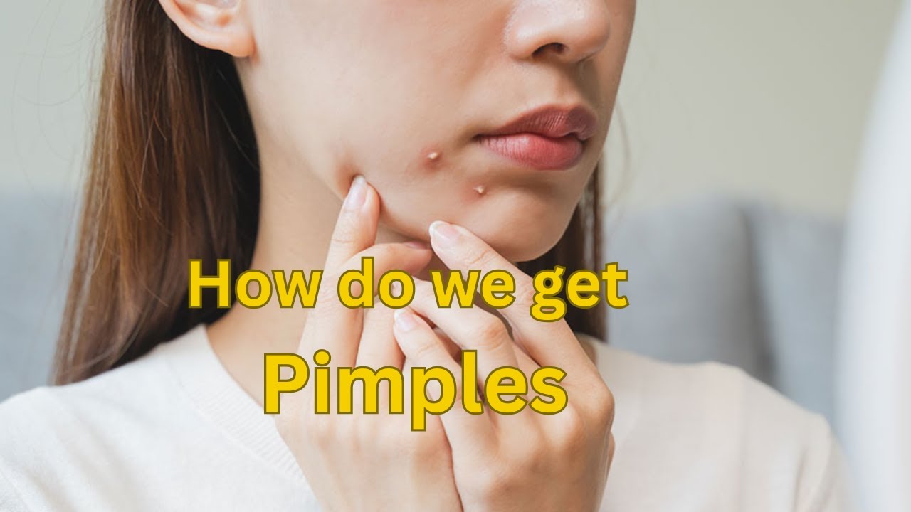 How Do We Get Pimples L Pimples On Face L Pimple Treatment L Pimples