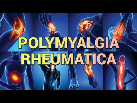 Polymyalgia Rheumatica Updated 2023 Crash Medical Review Series