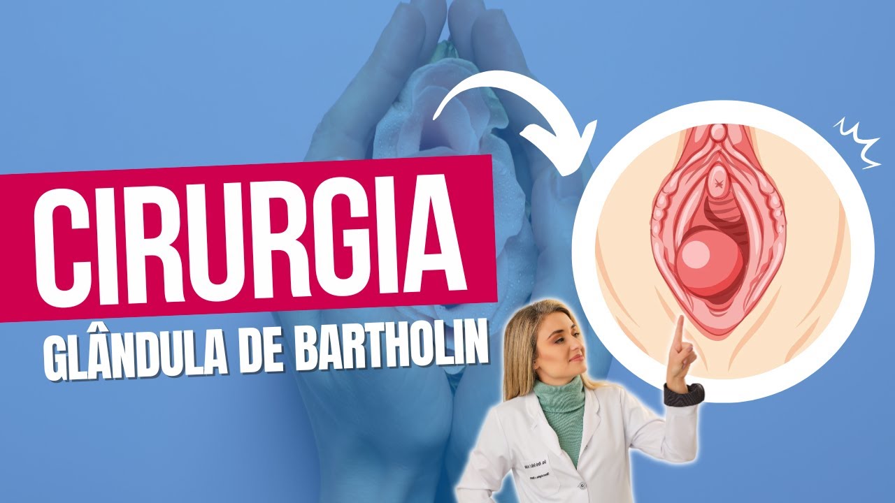 Cirurgia Da Glândula De Bartholin Youtube